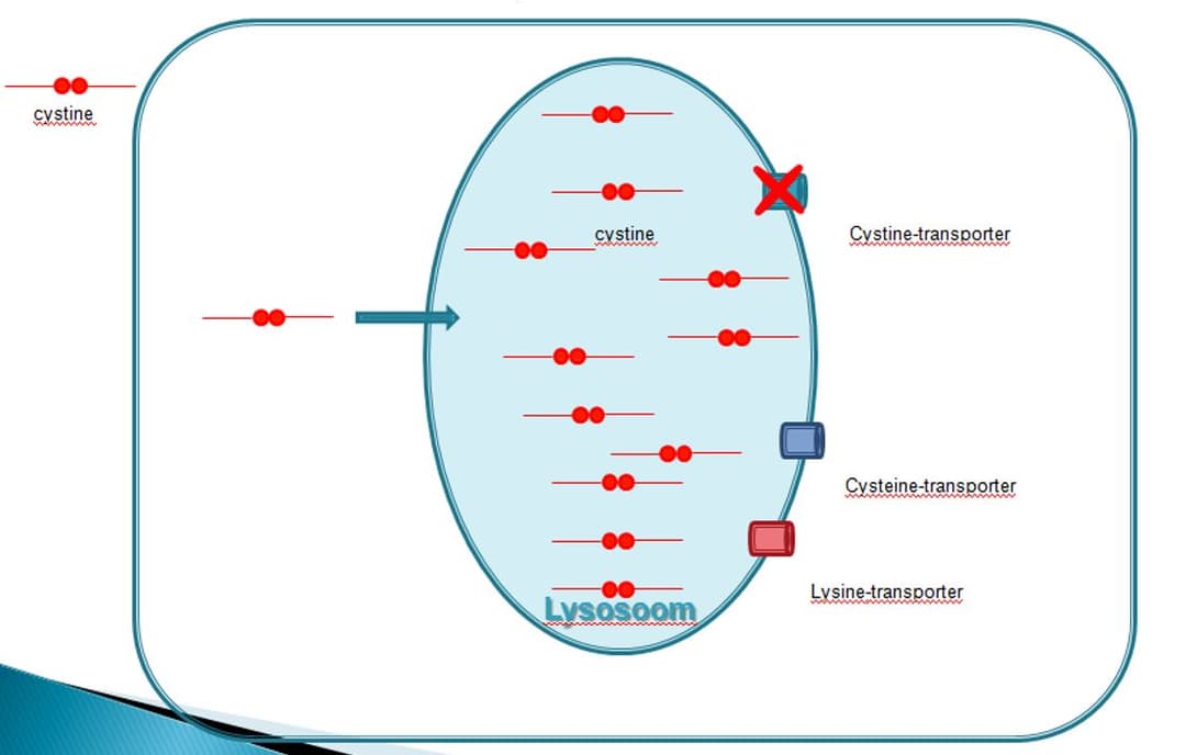 Cystinose | Nierstichting